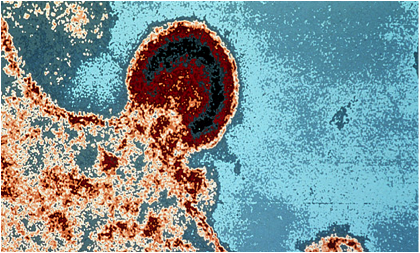 Newly discovered antiviral fights HIV, Ebola and other deadly viruses ...